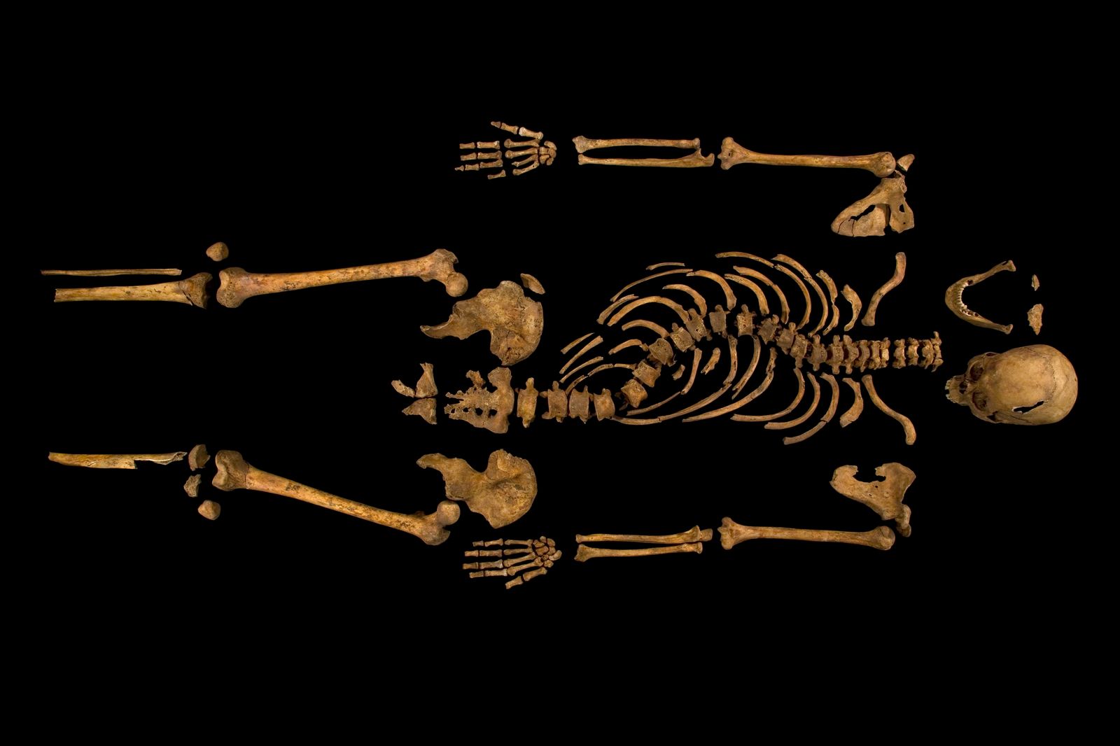 Exhibiting Human Skeletal Remains - Medieval Histories